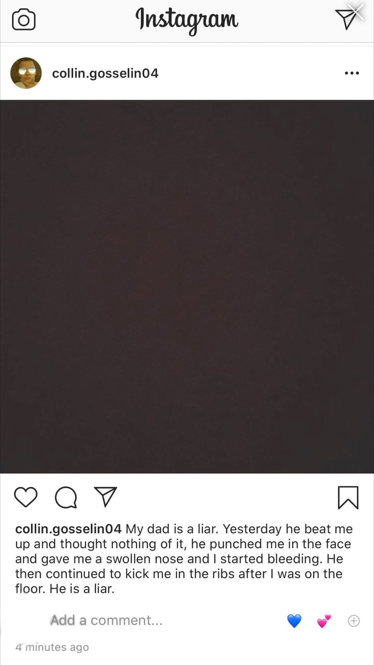 Jon Gosselin's 16-Year-Old Son Collin Claims Dad 'Beat Me Up ...