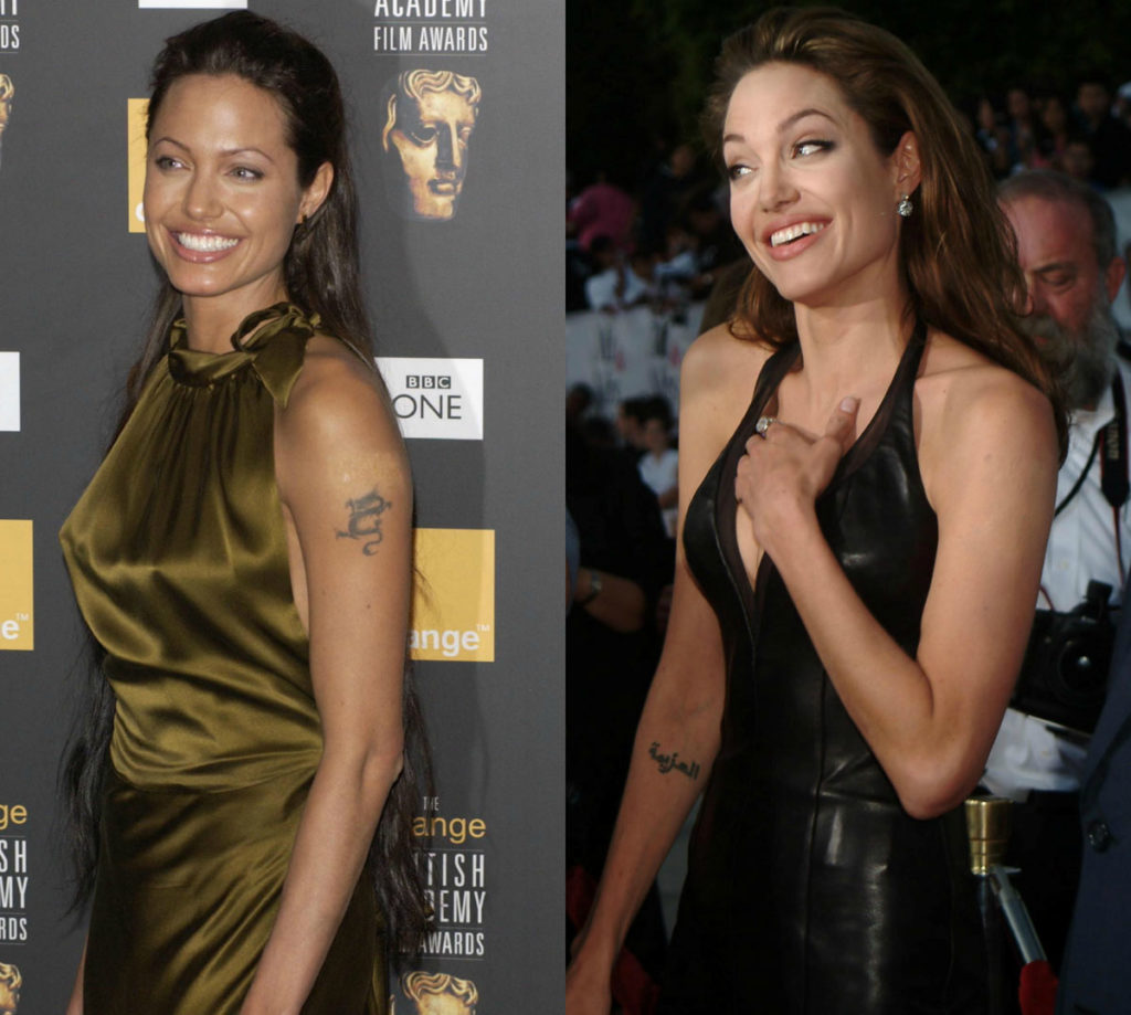 Stars Who Had Tattoos Removed Or Covered Up! - Perez Hilton