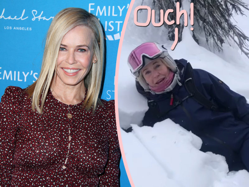 Chelsea Handler Injured After Scary Skiing Accident!! - Perez Hilton