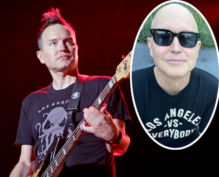 Mark Hoppus Shows Off The Return Of His Hair After Fifth Round Of ...