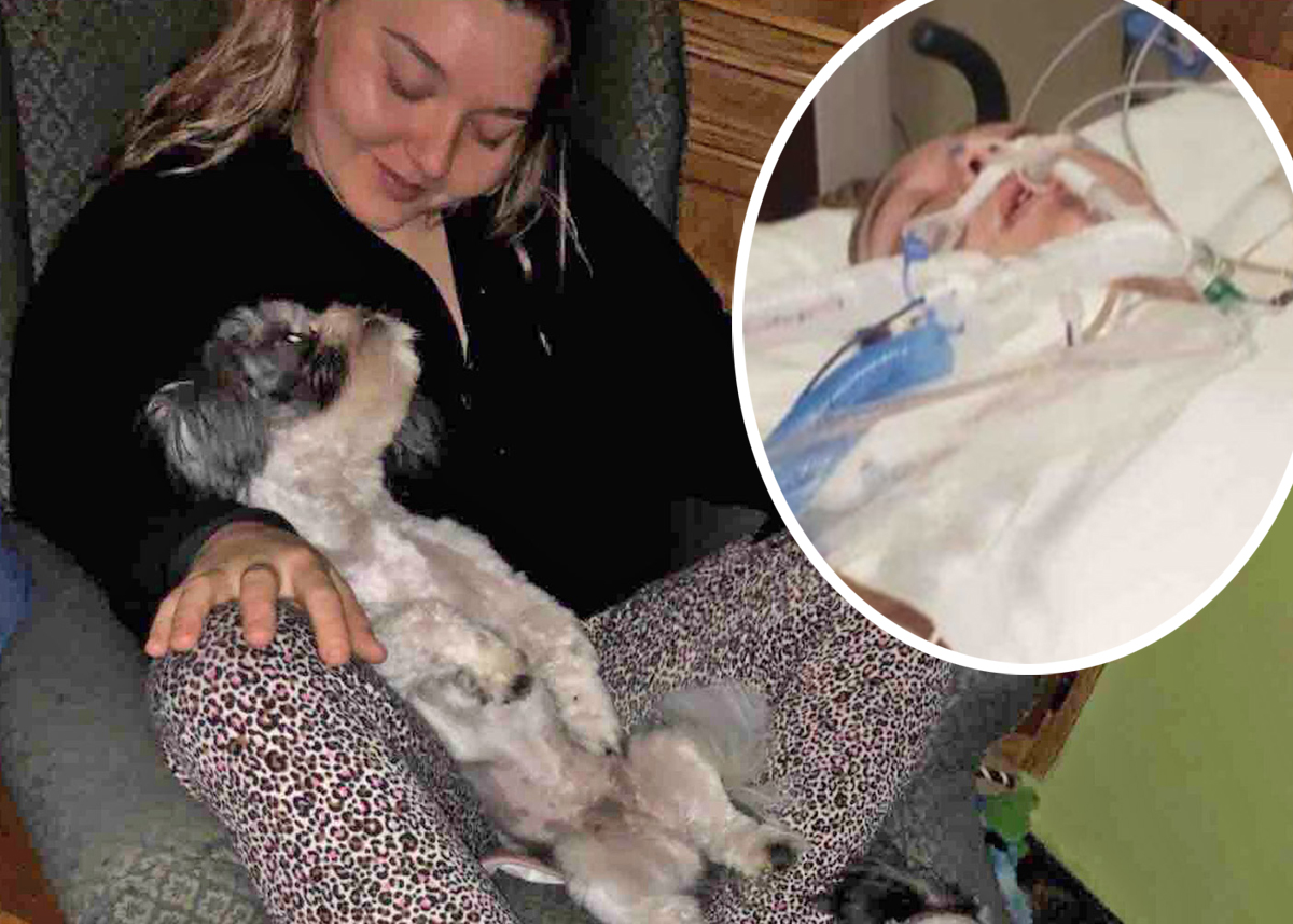Woman In Coma With Major Burns After Trying To Save Dog From ...