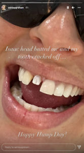 Ashley Graham Shares PAINFUL Photo Of Broken Tooth After Son Headbutts ...