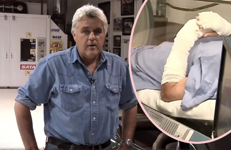 Recovering Jay Leno Seen For First Time Since Suffering Horrible Burns - Perez Hilton