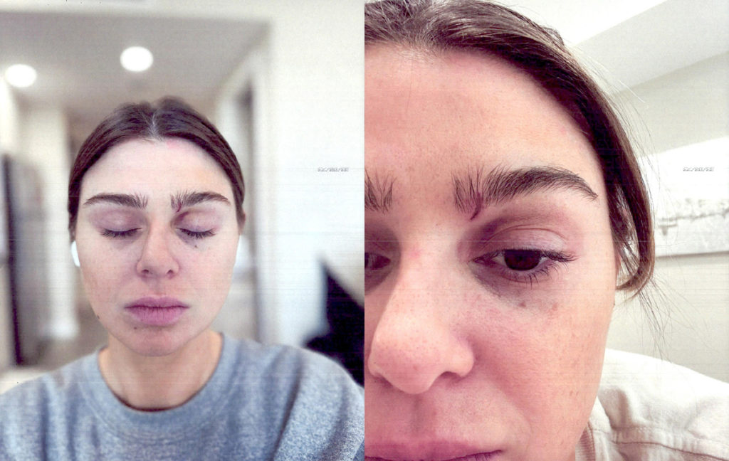 Raquel Leviss Reveals Injury To Her Eye - Allegedly From Scheana Shay Punch! See The Pics ...