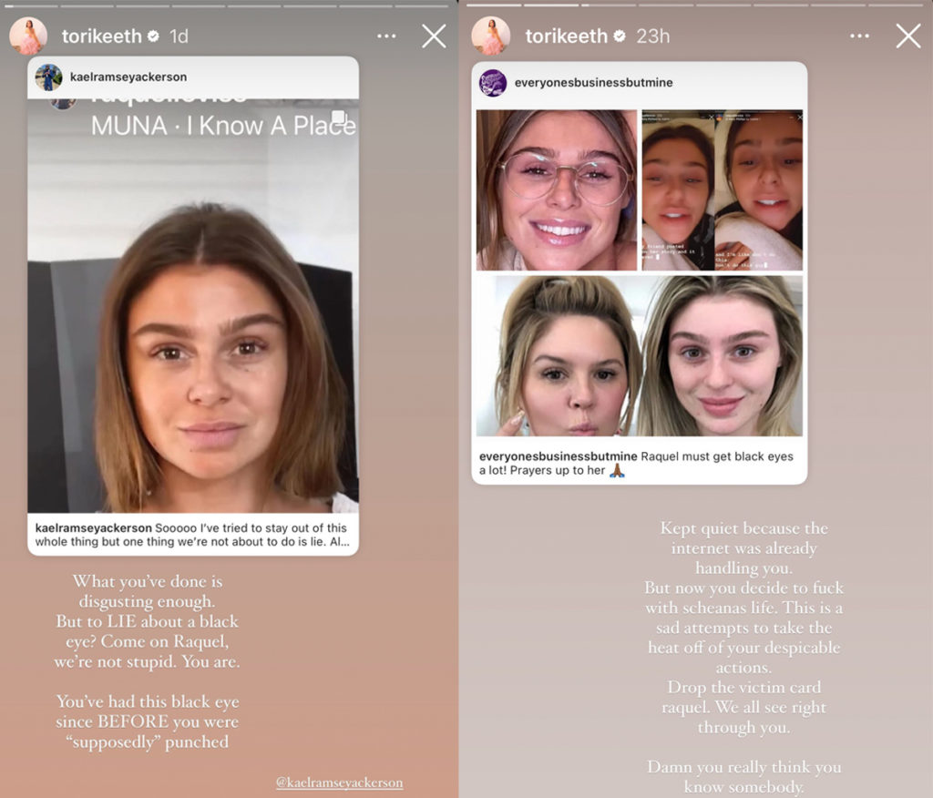 Scheana Shay DENIES Punching 'Liar And Cheat' Raquel Leviss – So Where DID The Black Eye Come ...