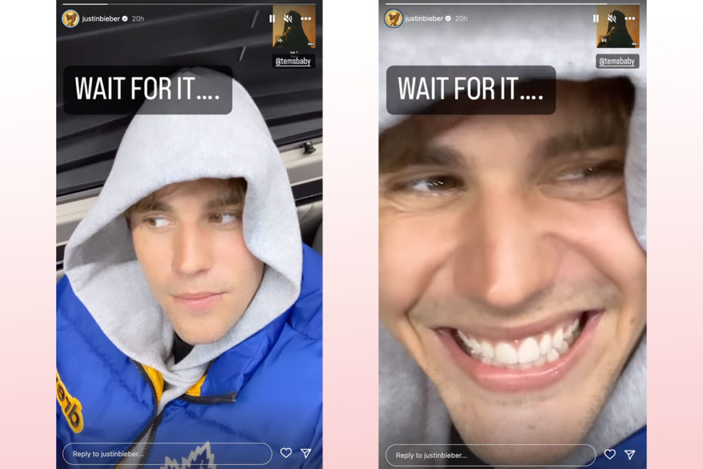 Justin Bieber Shares Update On Facial Paralysis Following Ramsay Hunt