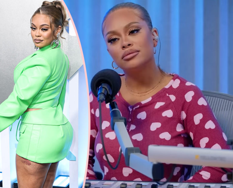 Why Latto Does NOT Recommend Plastic Surgery After Getting It Done ...