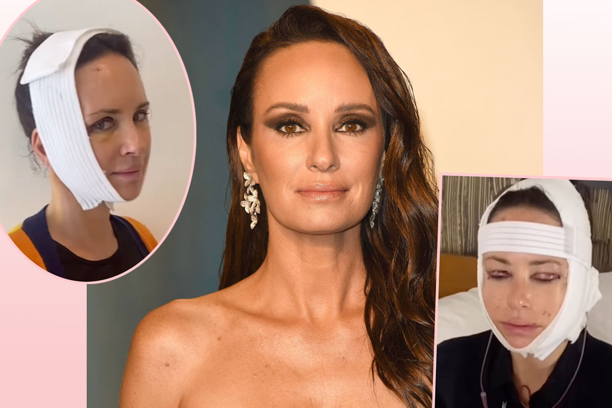 Catt Sadler Undergoes Major Facelift - And Gives ‘Zero F**ks What ...