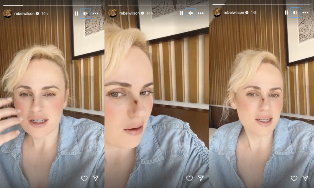 Rebel Wilson Explains Grisly Facial Injury From On-Set Prop Gun ...