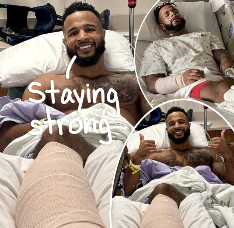 The Challenge Star's Foot To Be Amputated Exactly 1 Year After Fiery ...