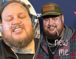 Jelly Roll Shares WILD Footage From Complete Oral 'Reconstructive ...