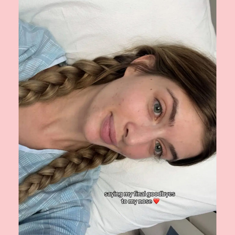 Sami Sheen Got A Nose Job - And Is Documenting Every Step On TikTok ...