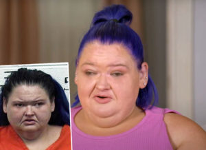 1,000-Lb. Sisters Star Amy Slaton WAS The One Bitten By Camel ...