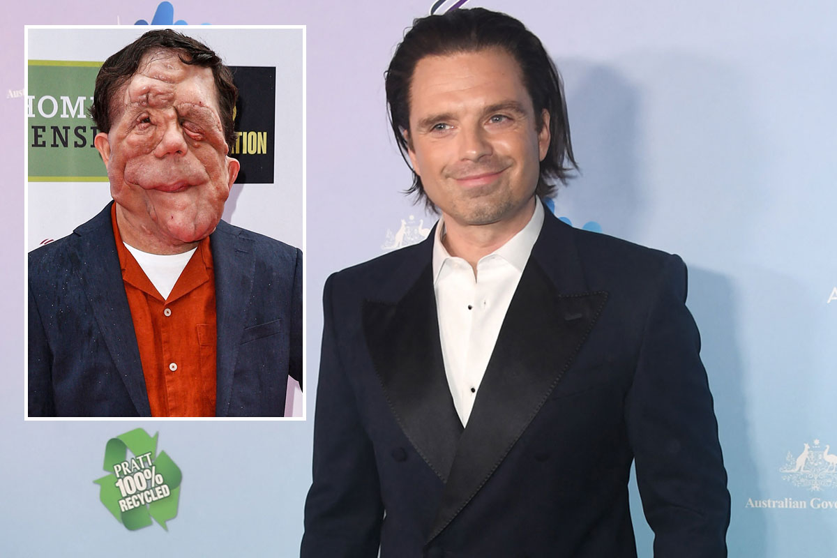 Sebastian Stan AVENGES Co-Star Who Suffers From Rare Facial ...
