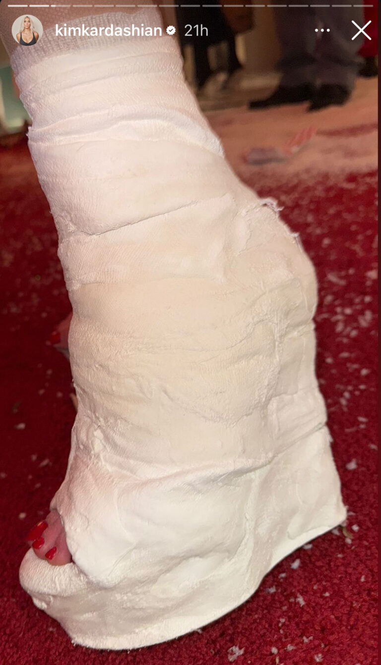 Kim Kardashian Is Now Getting Around… With A High-Heeled Cast On Her ...