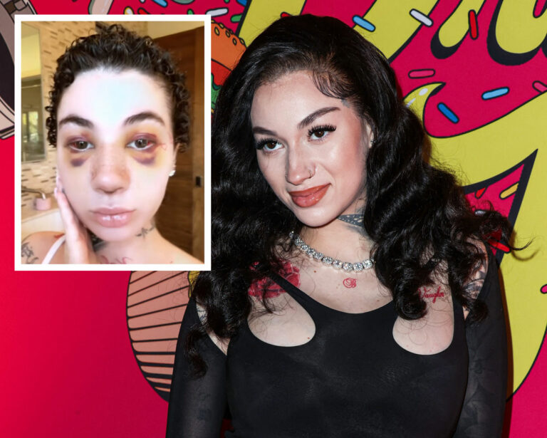 Bhad Bhabie Reveals She Got Nose Job And Clarifies Cancer Diagnosis ...