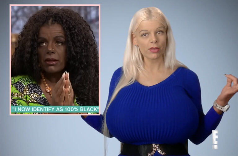 White Model From Botched Identifies As Black Now - And Plans To Move To ...