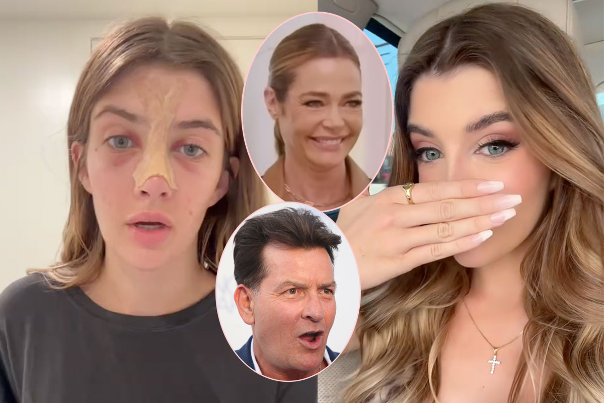 Sami Sheen CRIES When She Finally Sees Her Nose Job: 'Can't Believe It ...