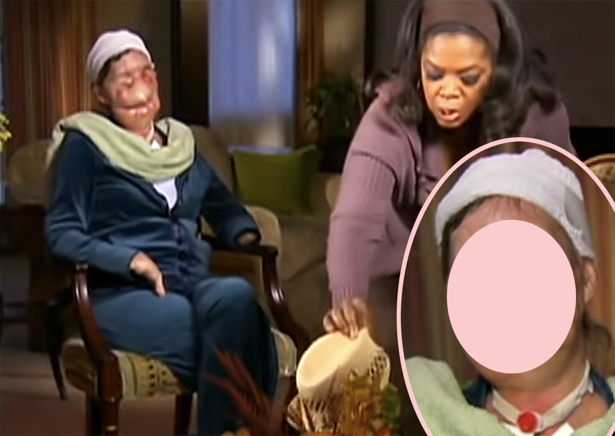 Woman Whose Face Was Ripped Off By Chimp In 2009 Reveals What She Looks ...