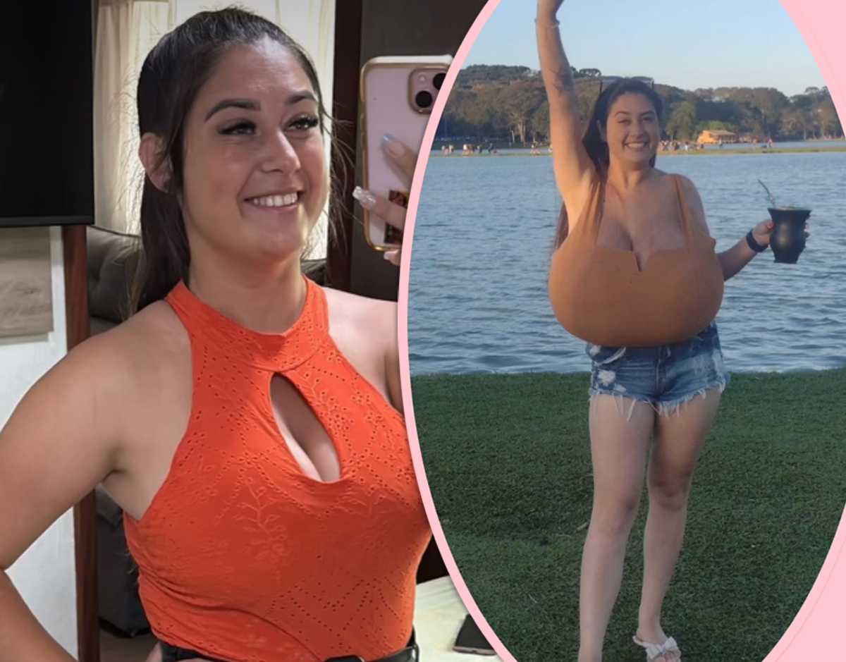 Woman's Breasts Grow ENORMOUS Within Months Due To Incredibly Rare Condition! - Perez Hilton