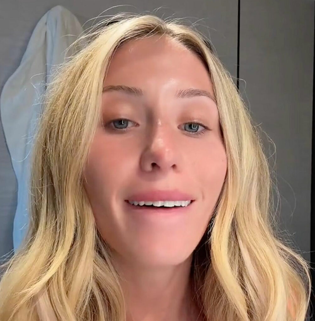 Influencer Alix Earle Reveals The ONE Cosmetic Surgery She Regrets ...