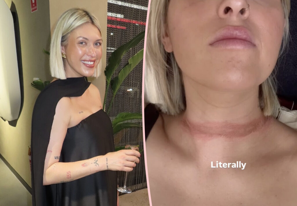 Influencer Almost 'Decapitated' When Her Scarf Got Caught Under Her Car ...