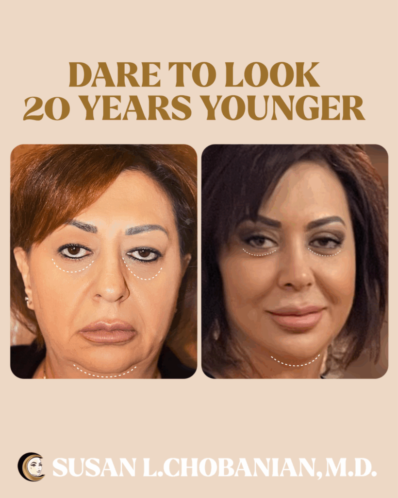 Turning Back Time: How Dr. Chobanian Helps Clients Look 20 Years ...