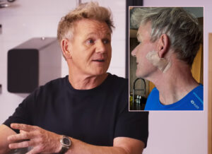 Gordon Ramsay Shows Off Surgery Scar As He Reveals Skin Cancer ...
